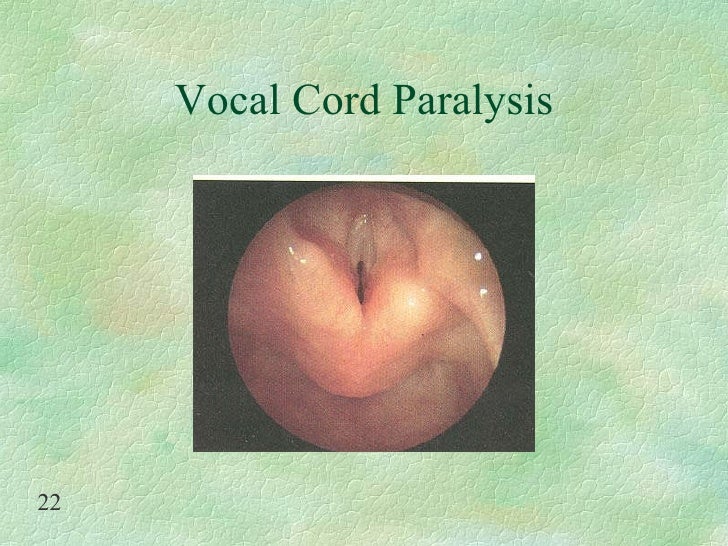 Pediatric Airway Emergencies,Evaluation And Management