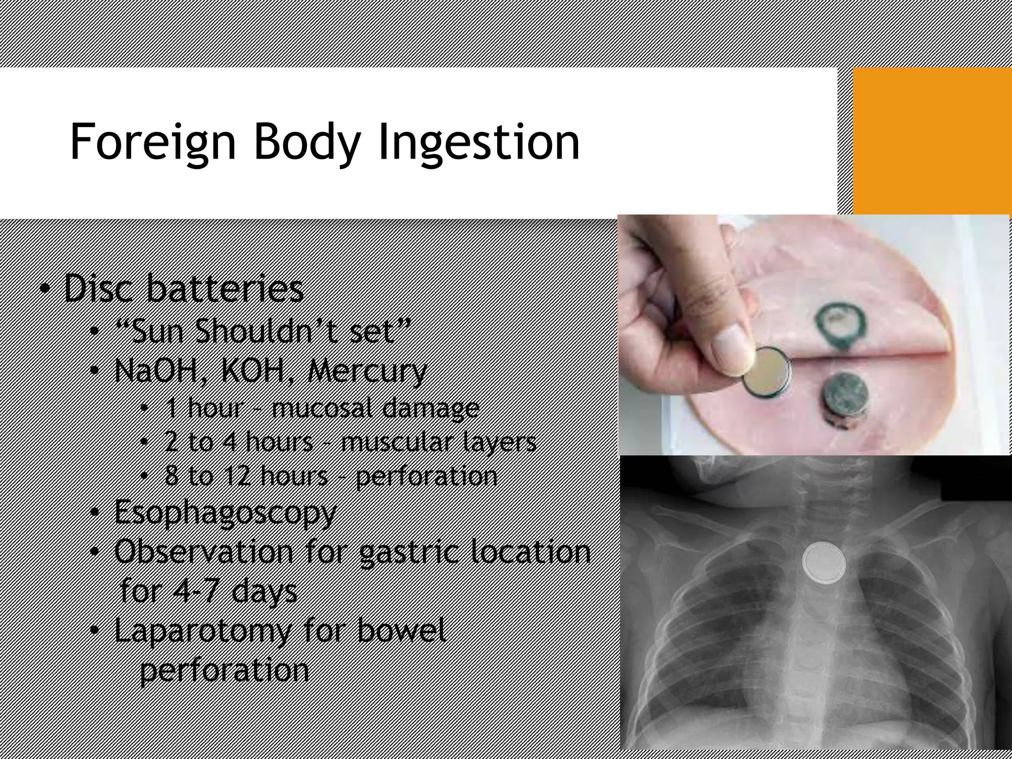Pediatric airway foreign body | PPT