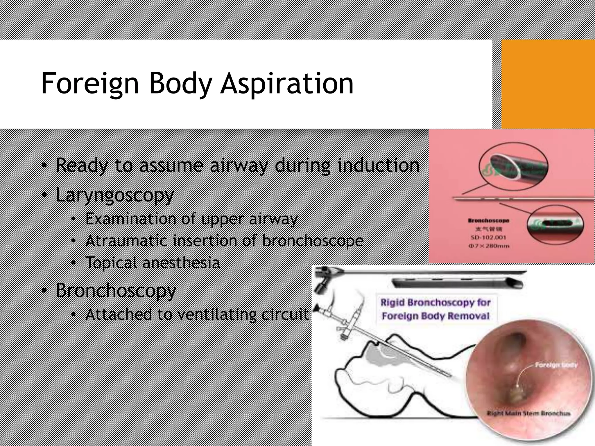 Pediatric airway foreign body | PPT