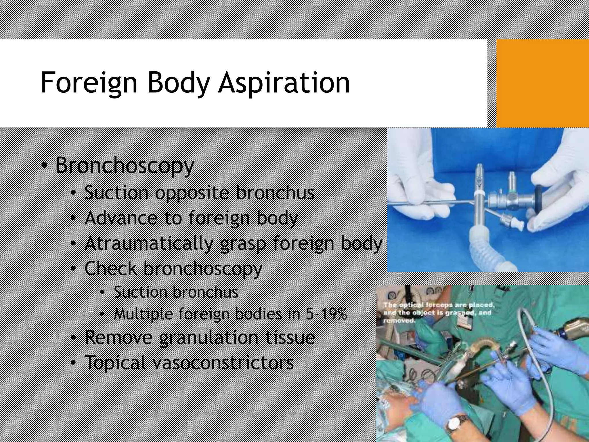 Pediatric airway foreign body | PPT
