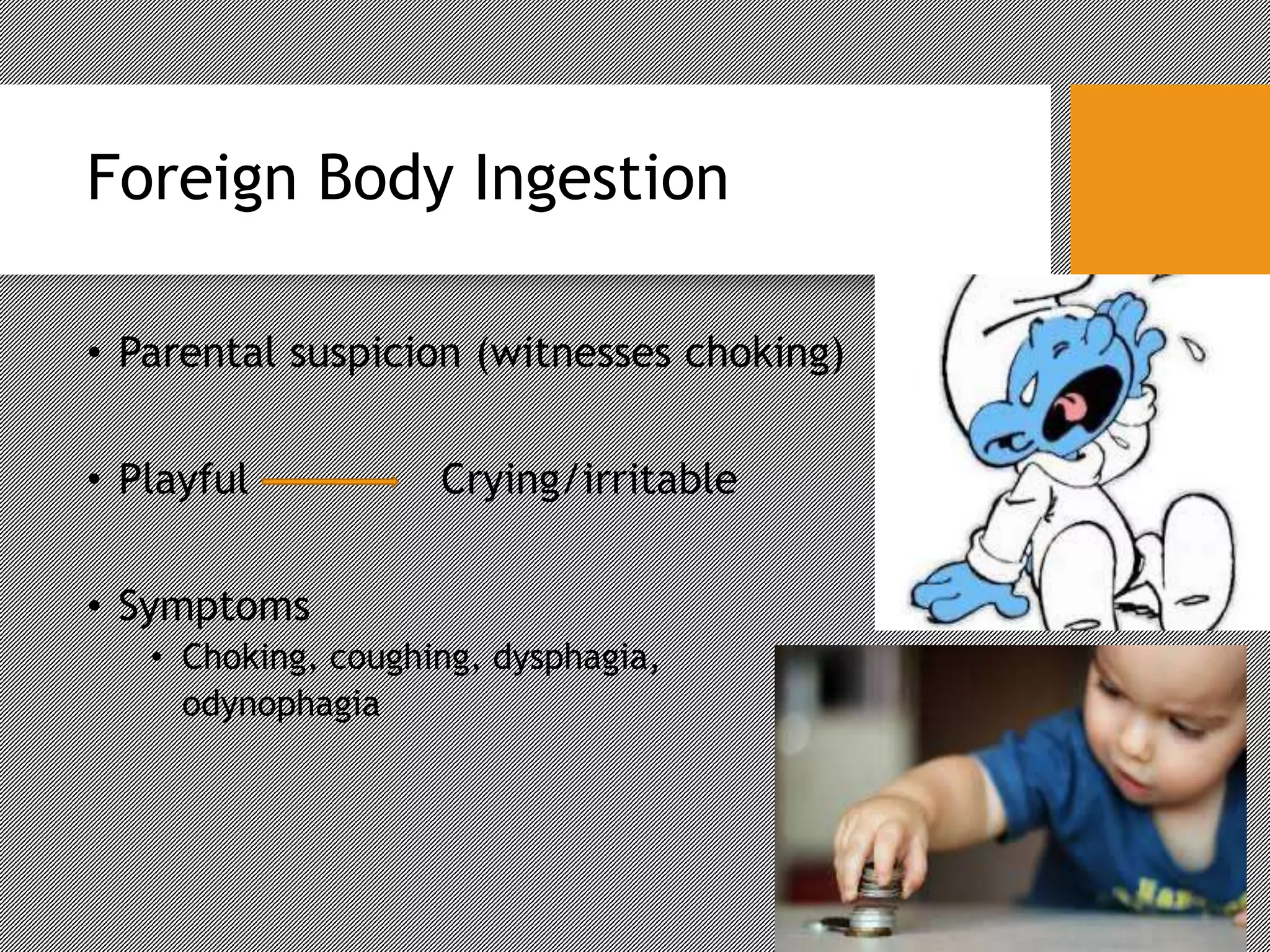 Pediatric airway foreign body | PPT