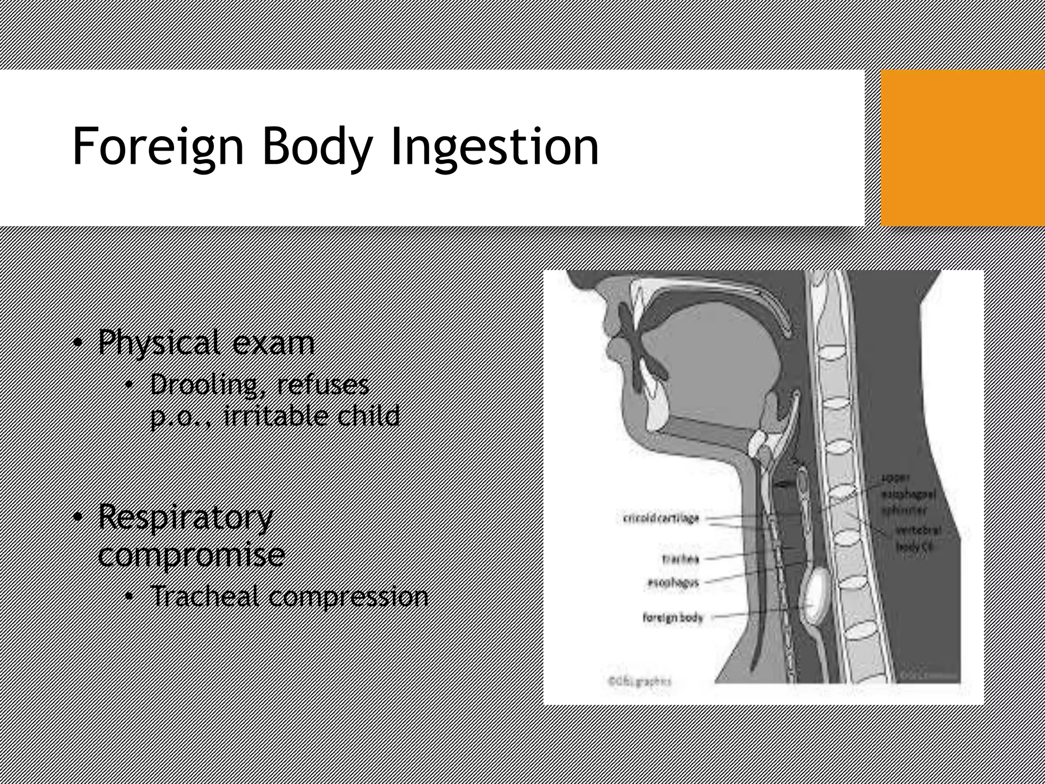Pediatric airway foreign body | PPT