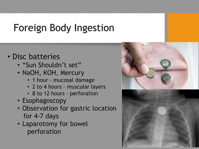 Pediatric airway foreign body | PPT | Lung and Respiratory Health ...