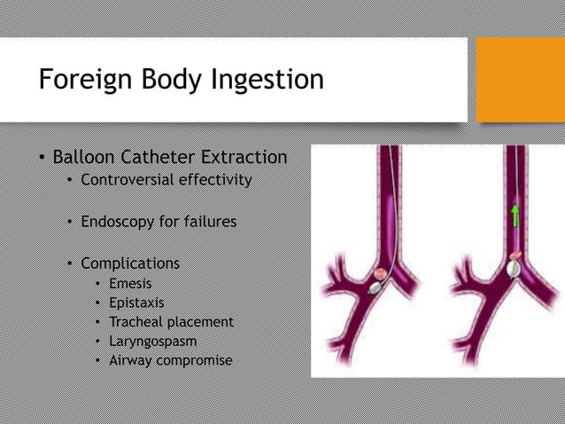 Pediatric airway foreign body | PPT | Lung and Respiratory Health ...