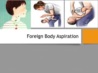 Pediatric airway foreign body | PPT | Lung and Respiratory Health ...