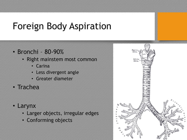Pediatric airway foreign body | PPT | Lung and Respiratory Health | Diseases and Conditions