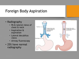 Pediatric airway foreign body | PPT