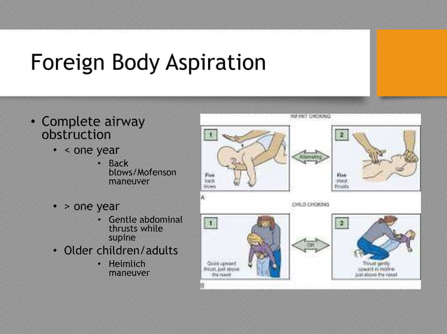 Pediatric airway foreign body | PPT | Lung and Respiratory Health ...