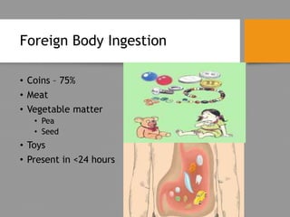 Pediatric airway foreign body | PPT