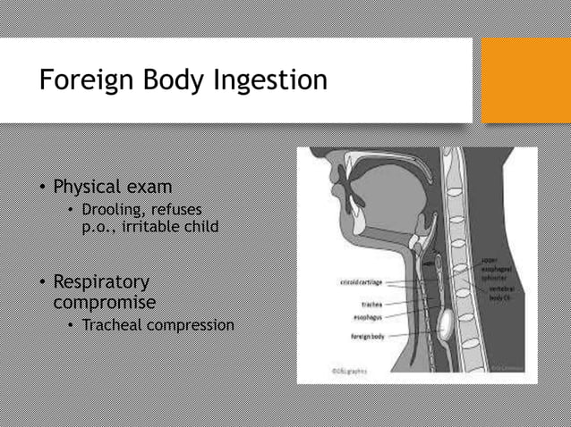 Pediatric airway foreign body | PPT | Lung and Respiratory Health ...