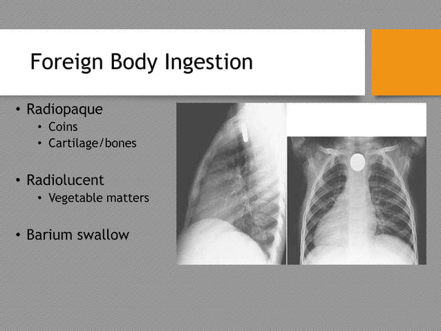 Pediatric airway foreign body | PPT | Lung and Respiratory Health ...
