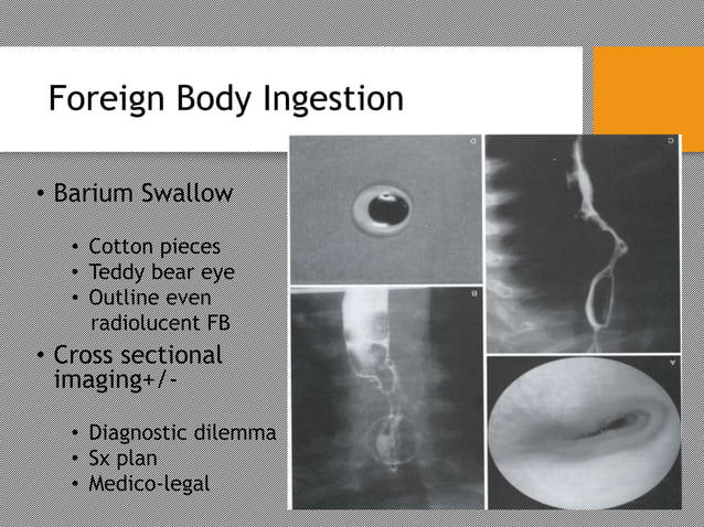 Pediatric airway foreign body | PPT | Lung and Respiratory Health ...