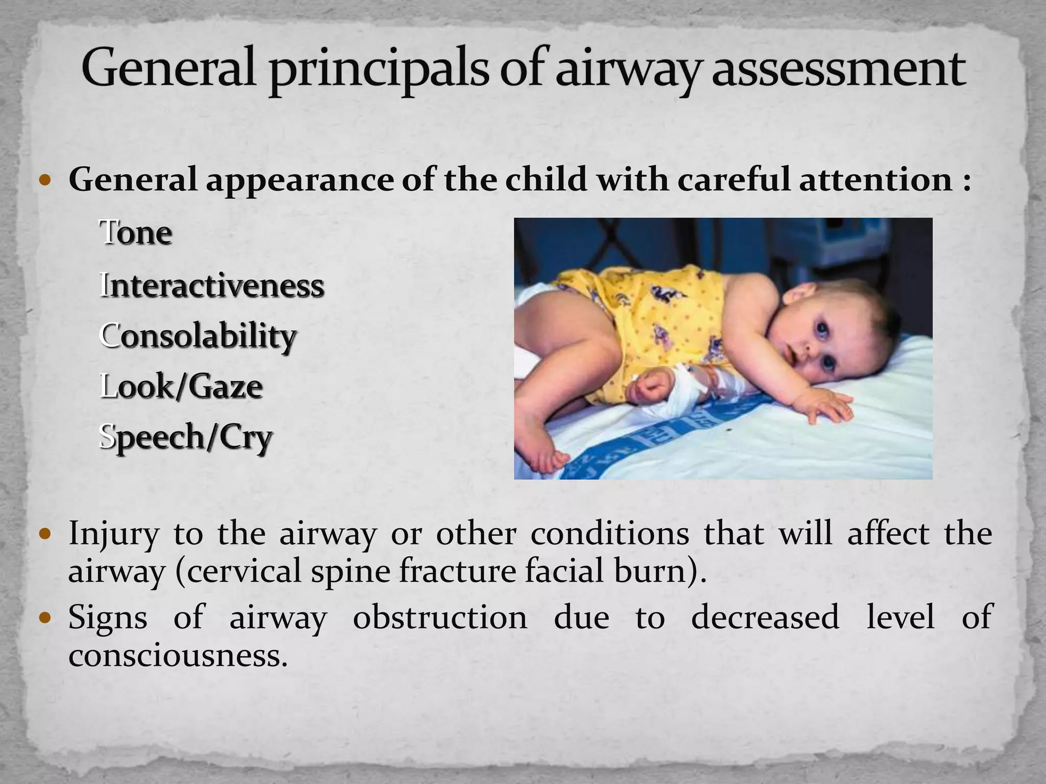 Pediatric airway management | PPTX