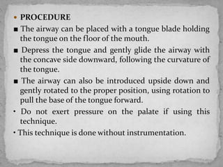 Pediatric airway management | PPTX