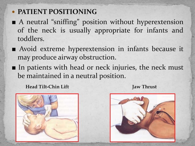 Pediatric airway management | PPTX