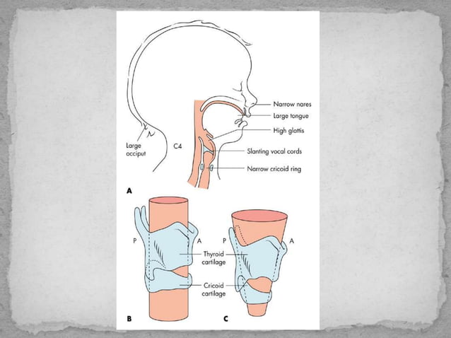 Pediatric airway management