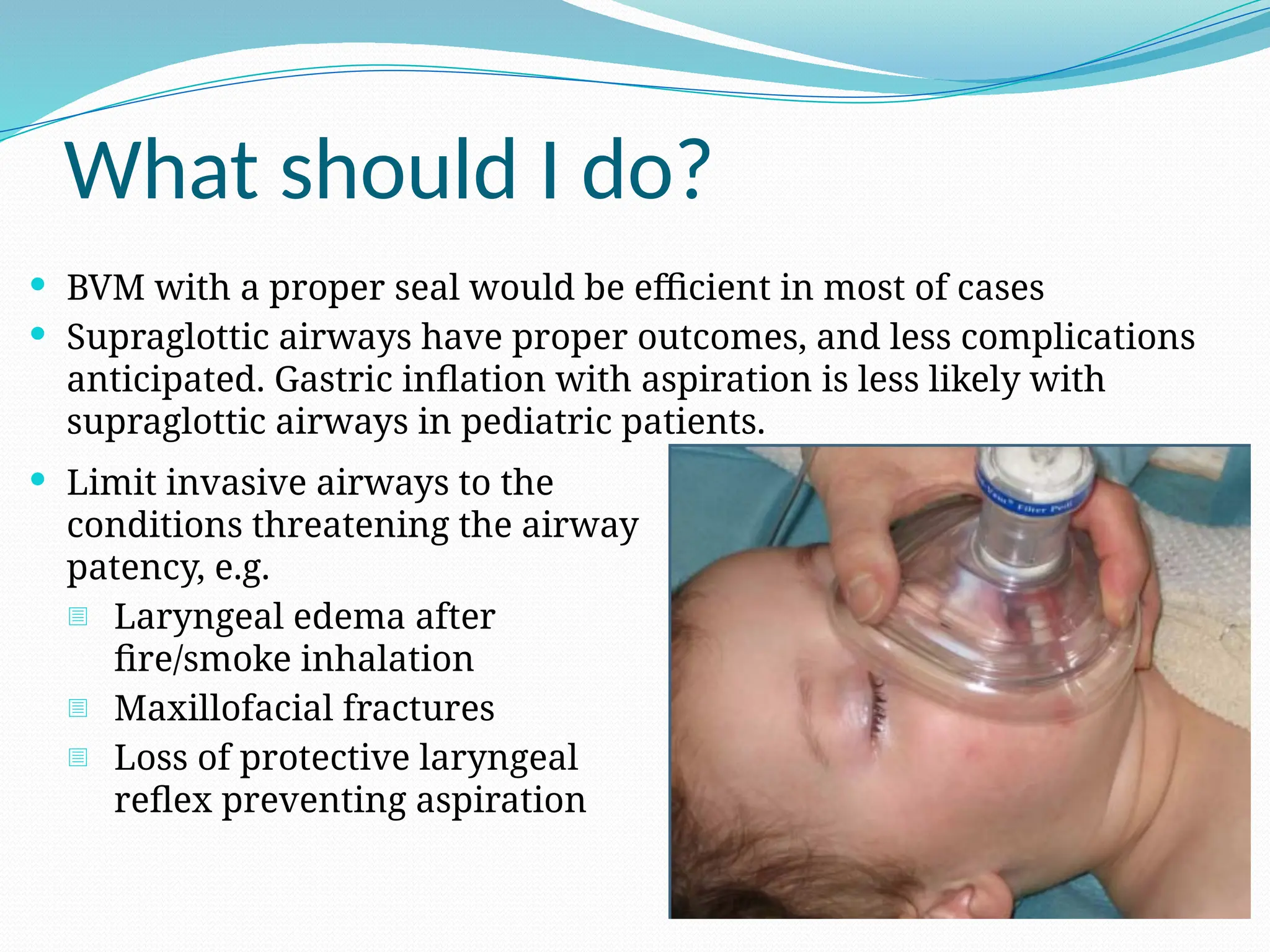 Pediatric Airway Management Explanation and challenges | PPTX