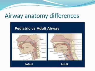 Pediatric Airway Management Explanation and challenges | PPTX