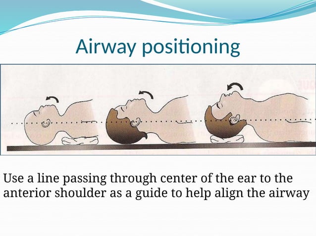 Pediatric Airway Management Explanation and challenges | PPTX