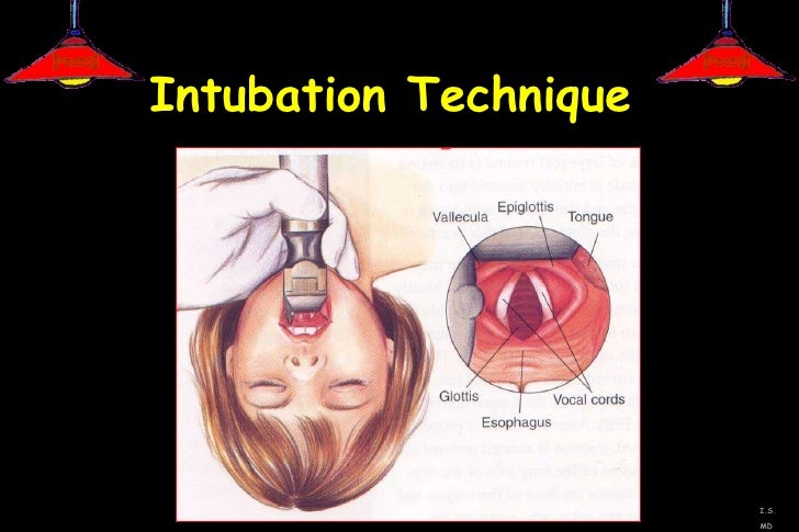 Pediatric airway management shapiro