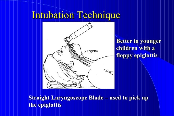 Pediatric airway management winkler
