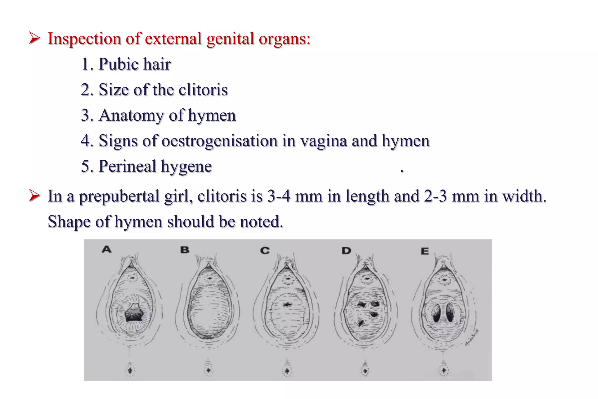 Pediatric and adolescent gynecology koc univ. web | PPTX
