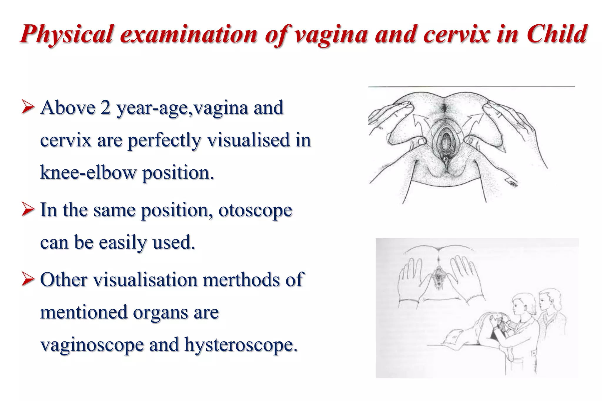 Pediatric and adolescent gynecology koc univ. web | PPTX