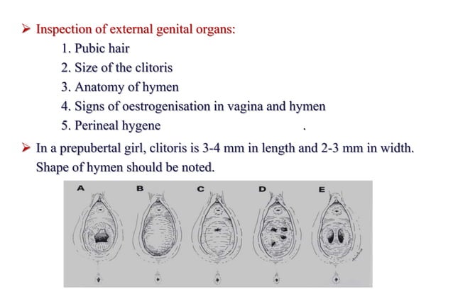 Pediatric and adolescent gynecology koc univ. web | PPTX | Pregnancy ...
