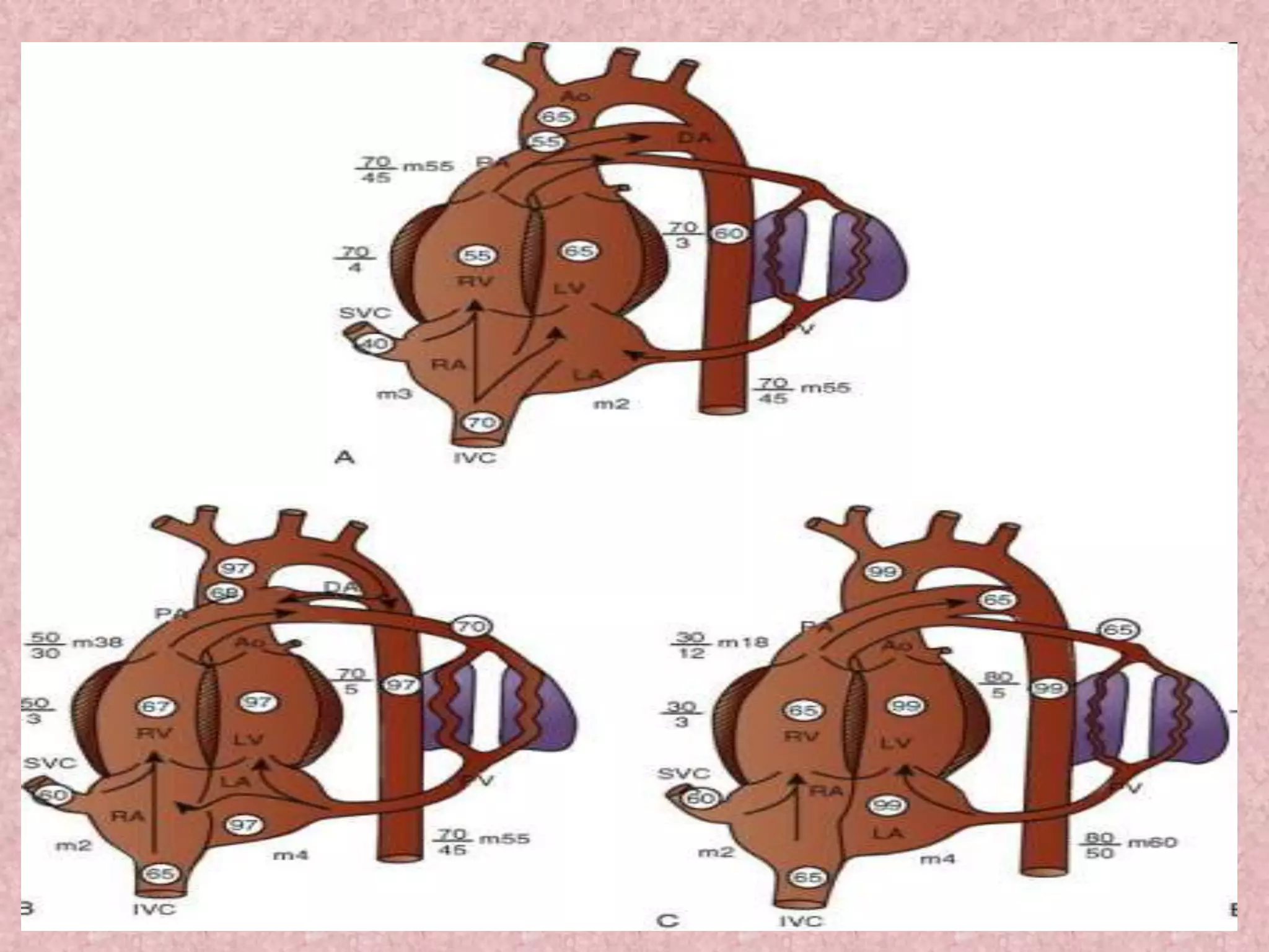 Pediatric anesthesia and cardiac problems 1 | PPT