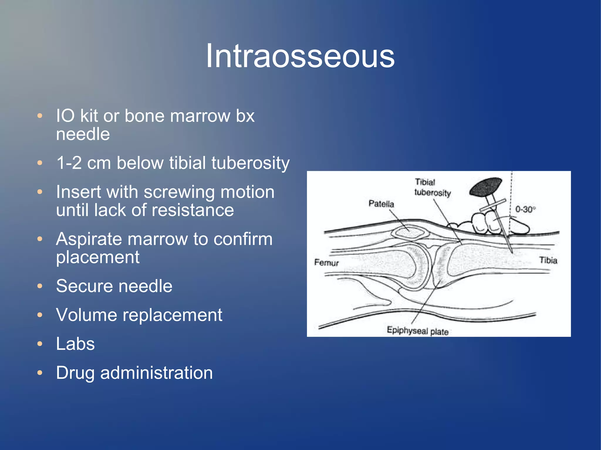 Pediatric anesthesiology board review | ODP