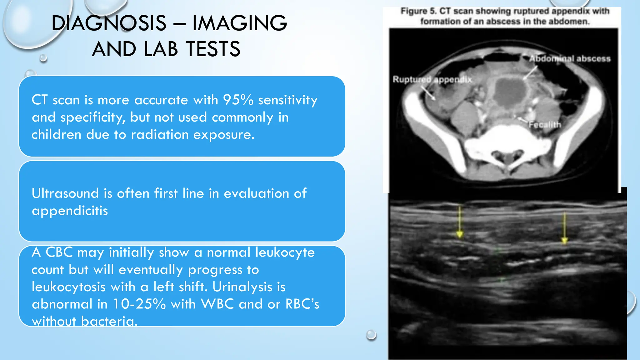 discussion on Pediatric Appendicitis case.pptx