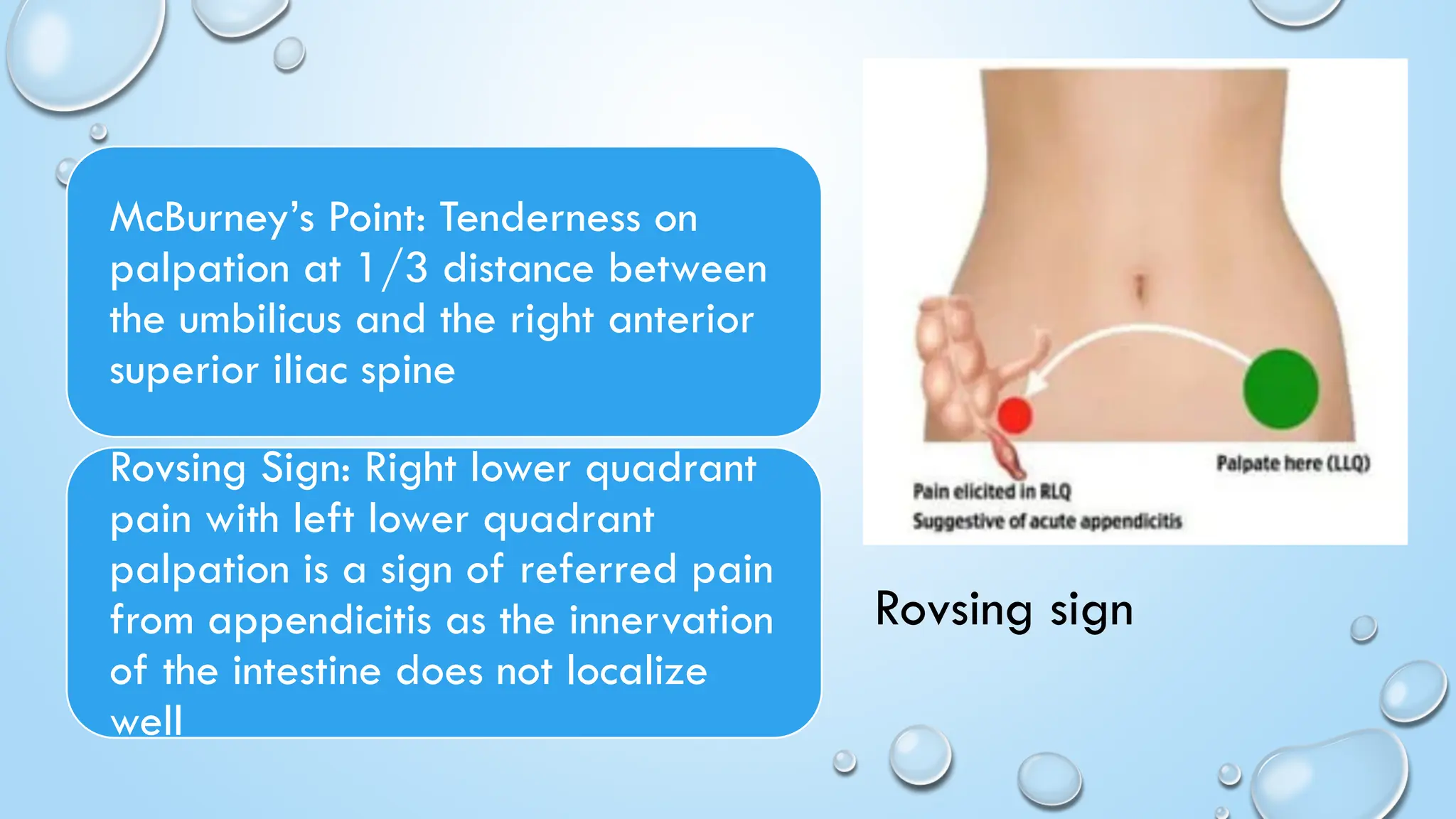 discussion on Pediatric Appendicitis case.pptx