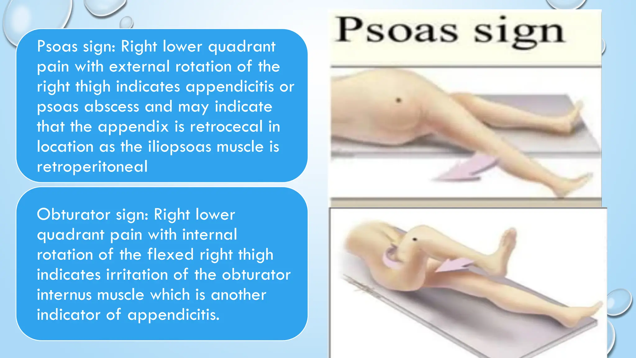discussion on Pediatric Appendicitis case.pptx