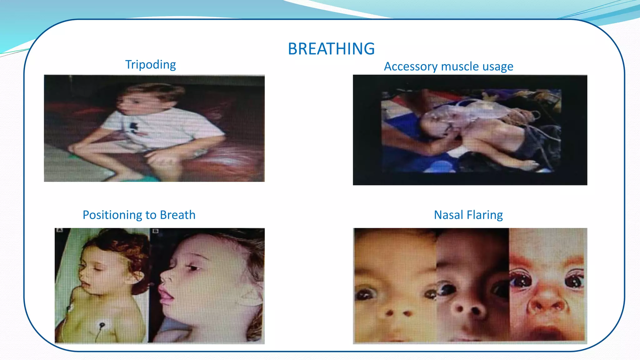 Pediatric assessment DR ATIQUR RAHMAN KHAN | PPTX
