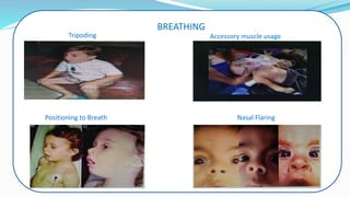 Pediatric assessment DR ATIQUR RAHMAN KHAN | PPTX