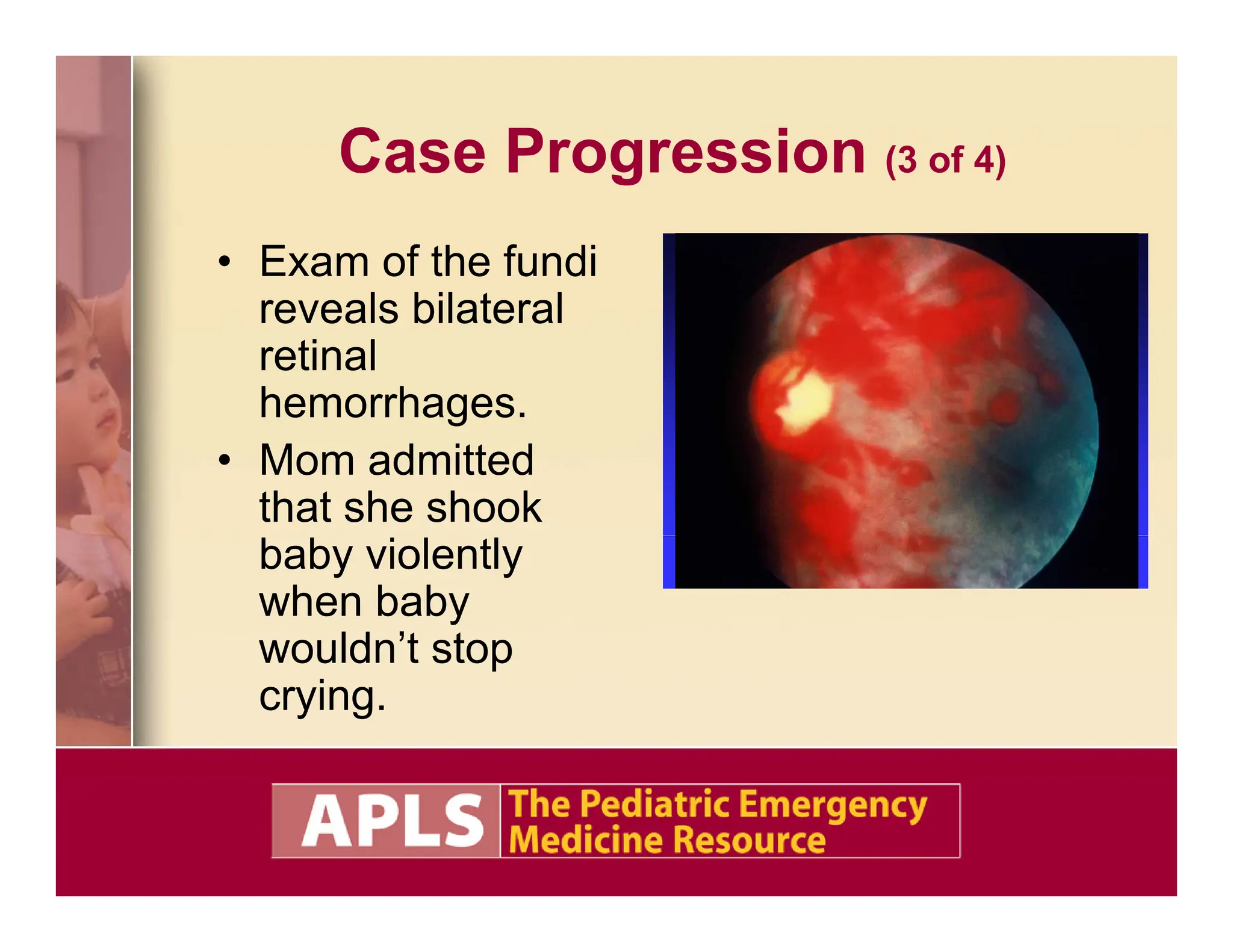 Pediatric Assessment Triangle in Children. pdf | PDF