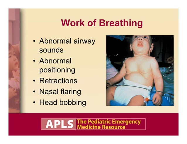 Pediatric Assessment Triangle in Children. pdf | PDF