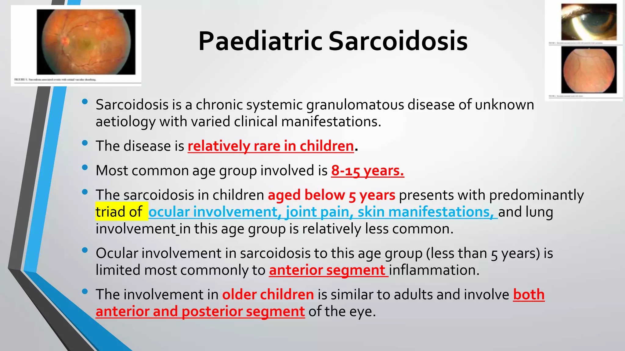 Pediatric autoimmune uveitis.pptx