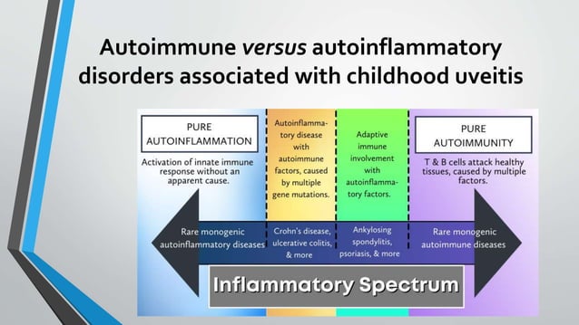 Pediatric autoimmune uveitis.pptx