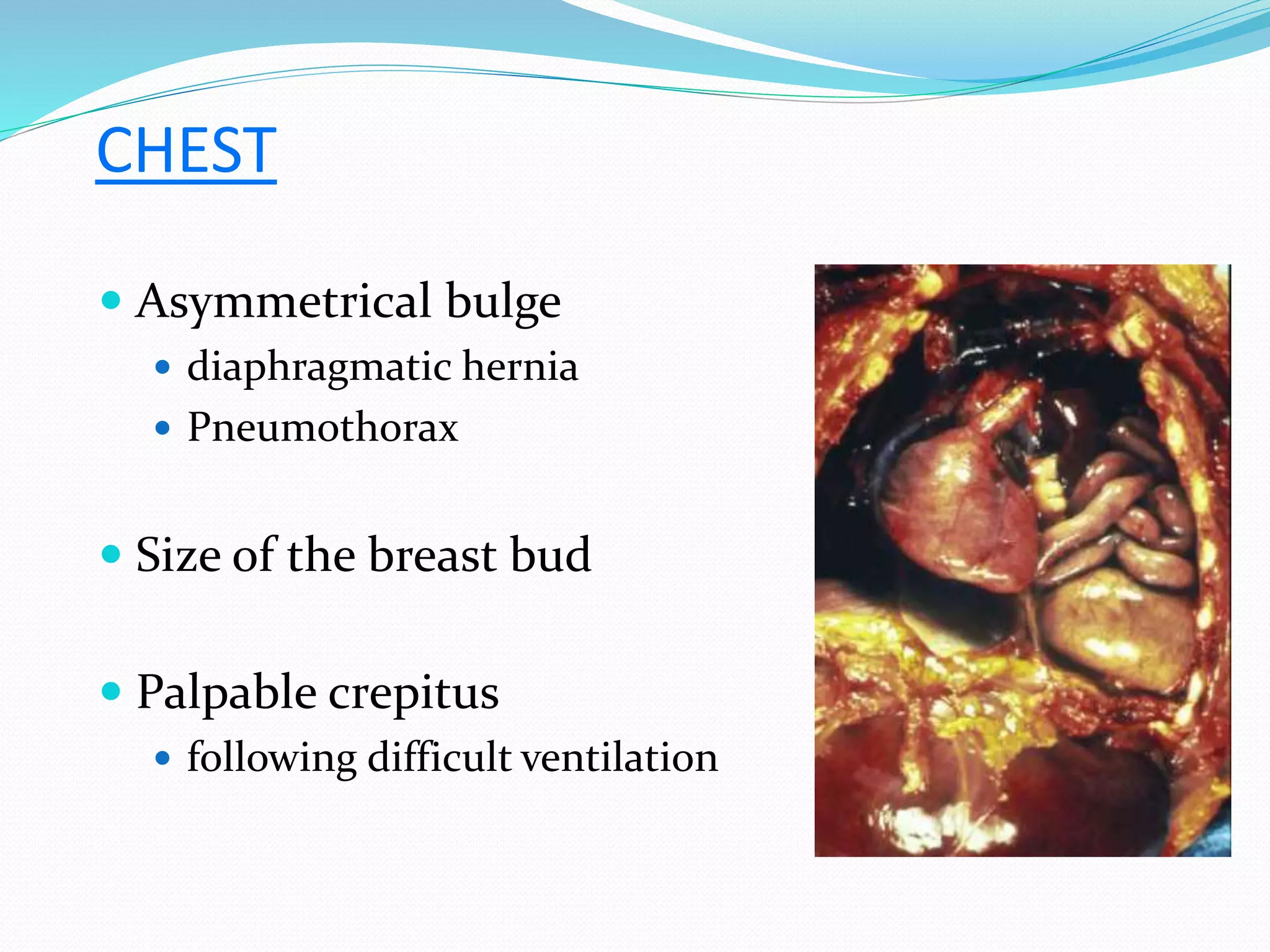 Pediatric autopsy.pptx