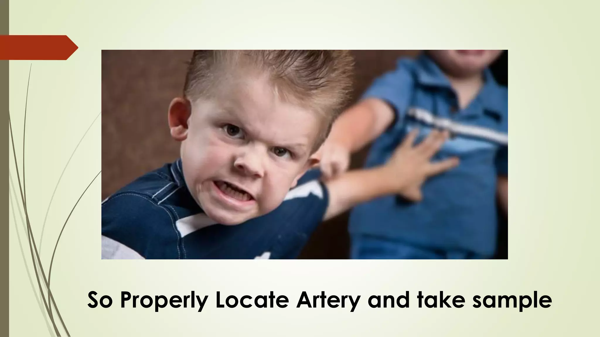 Pediatric blood sampling technique | PDF