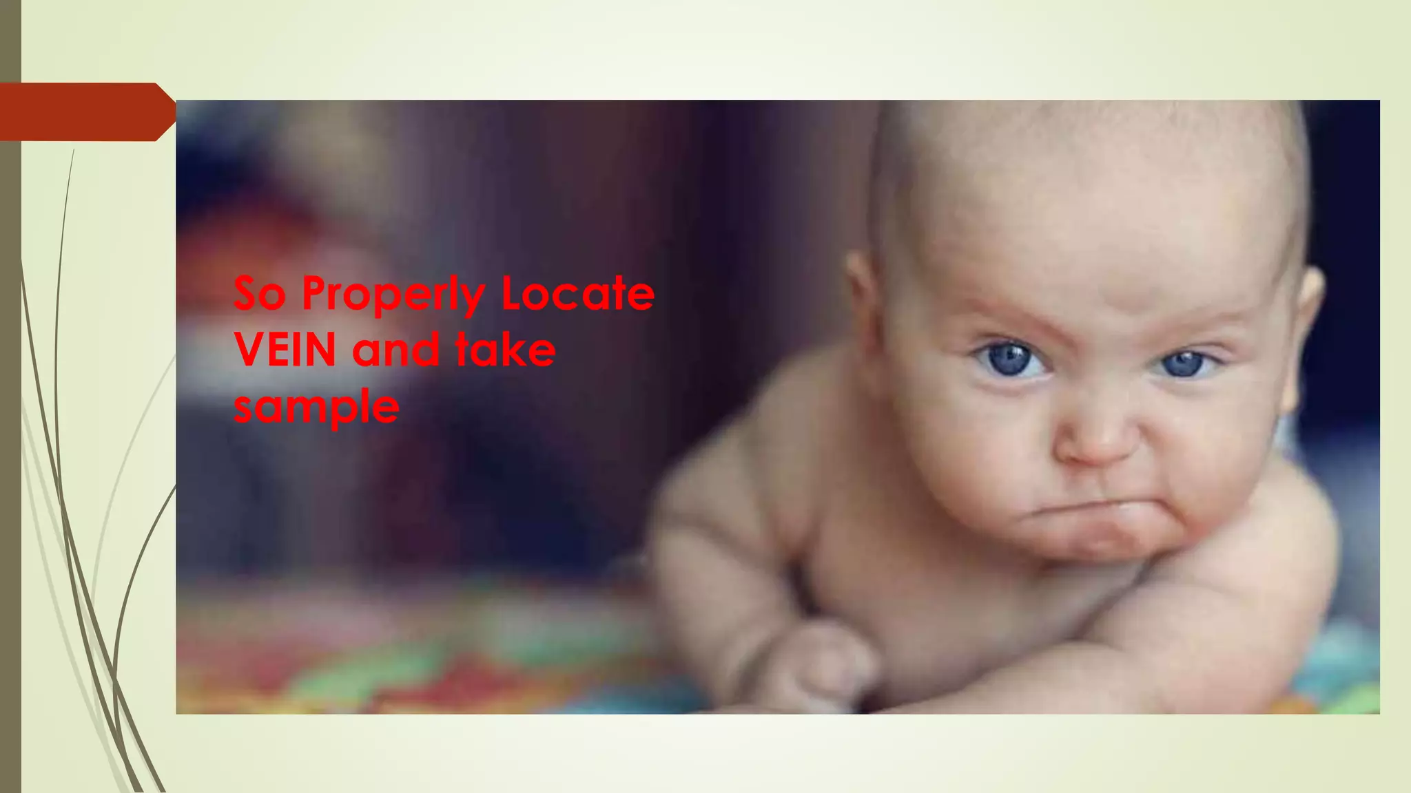 Pediatric blood sampling technique | PDF