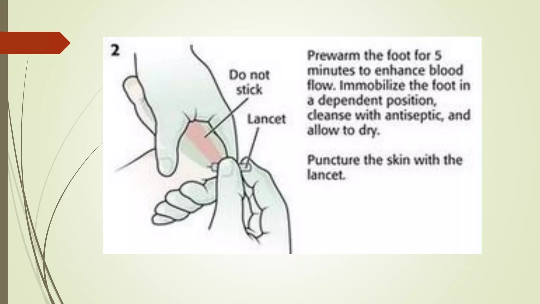 Pediatric blood sampling technique | PDF
