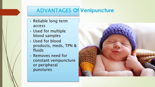 Pediatric blood sampling technique | PDF