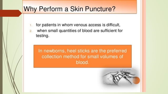 Pediatric blood sampling technique | PDF