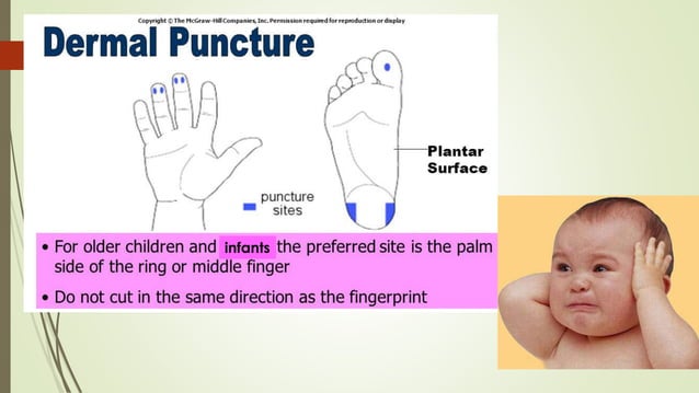Pediatric blood sampling technique | PDF