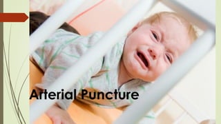 Pediatric blood sampling technique | PDF