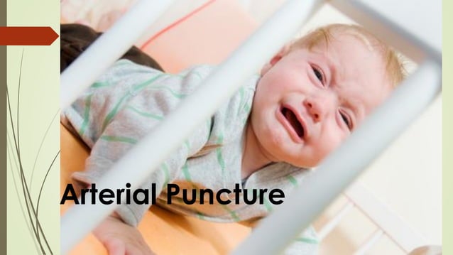 Pediatric blood sampling technique | PDF