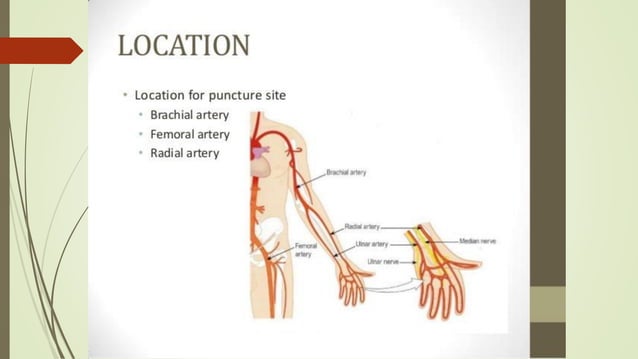 Pediatric blood sampling technique | PDF