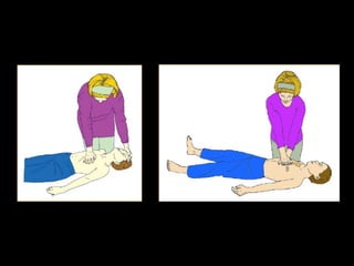 FA: Pediatric bls | PPT